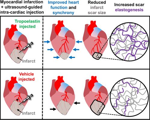 Heart Attack: Tropoelastin Restores Muscle Elasticity after a ...